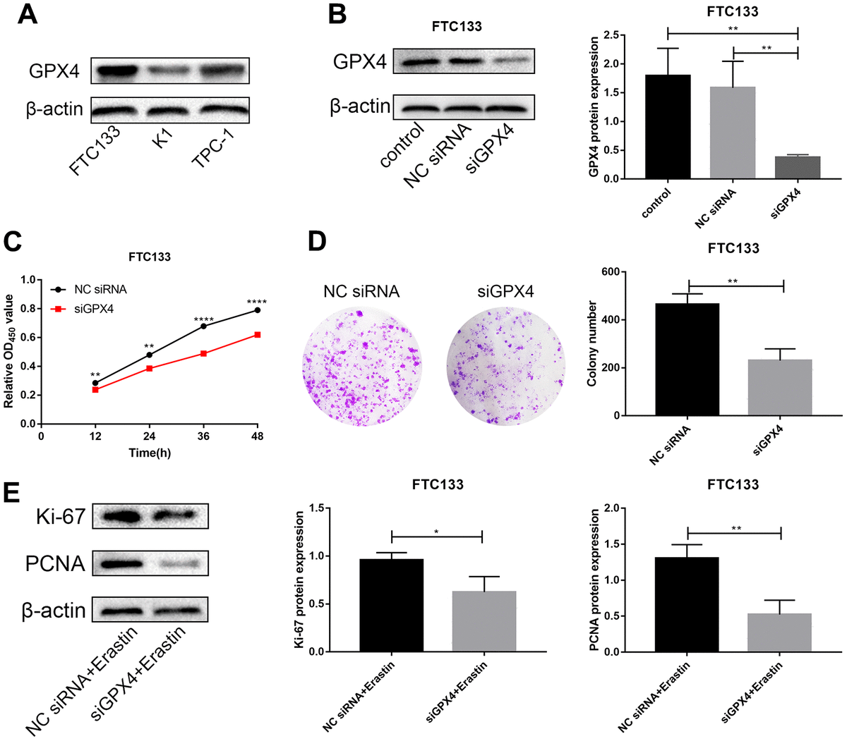 Increased expression of GPX4 promotes the tumorigenesis of thyroid ...