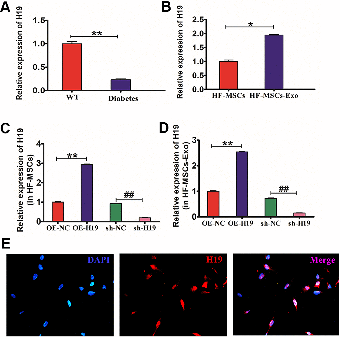 Hair follicle mesenchymal stem cell exosomal lncRNA H19 inhibited NLRP3 pyroptosis to promote ...