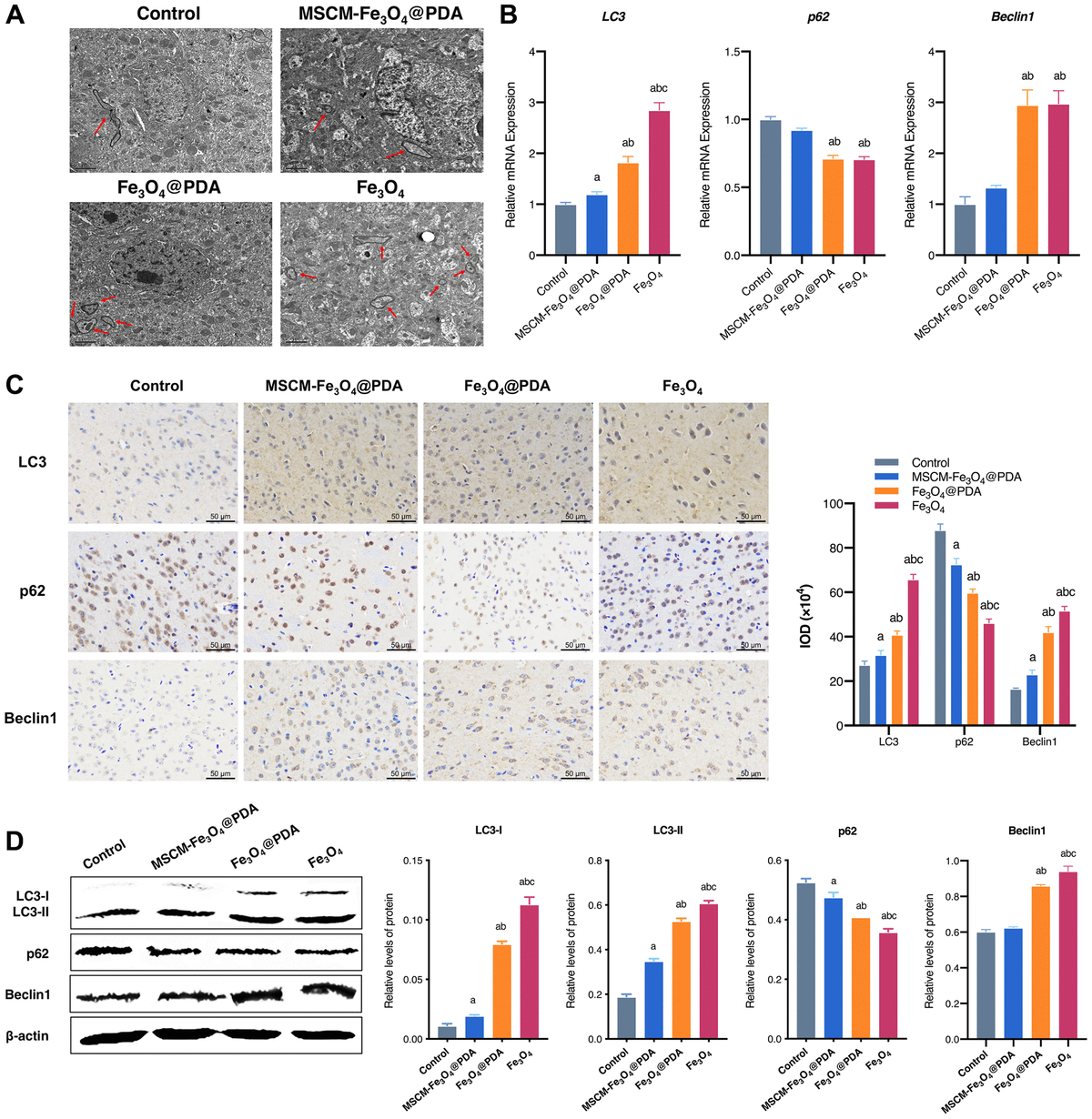Combined surface functionalization of MSC membrane and PDA inhibits ...