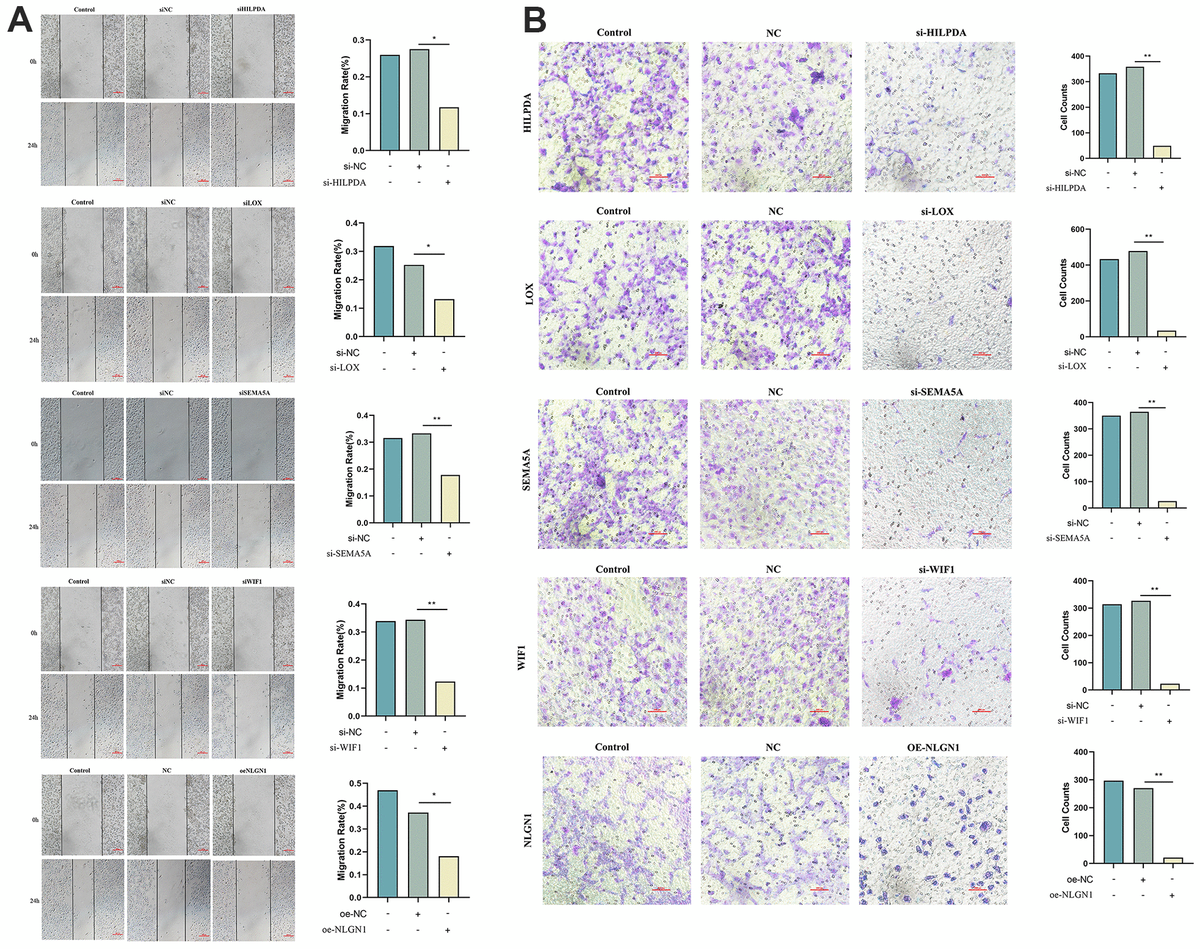 Metastasis-related gene signature associates with immunity and predicts ...