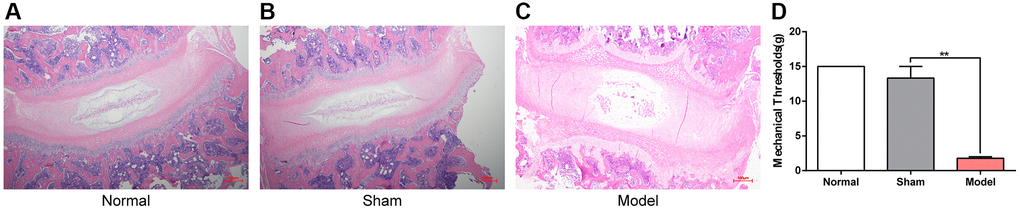 Needle-scalpel therapy inhibits the apoptosis of nucleus pulposus cells ...